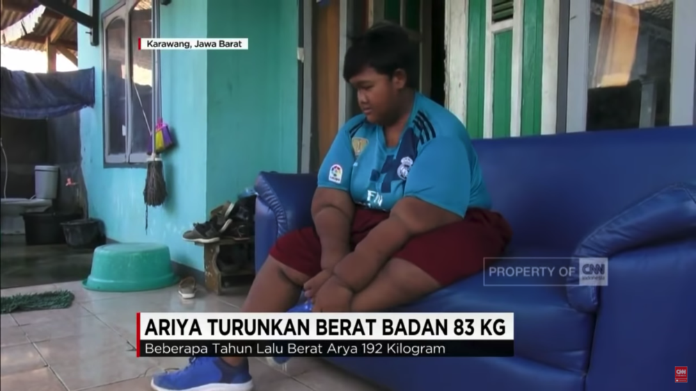 192kg世界一太った10歳の肥満児が83kgダイエット成功ビフォーアフター