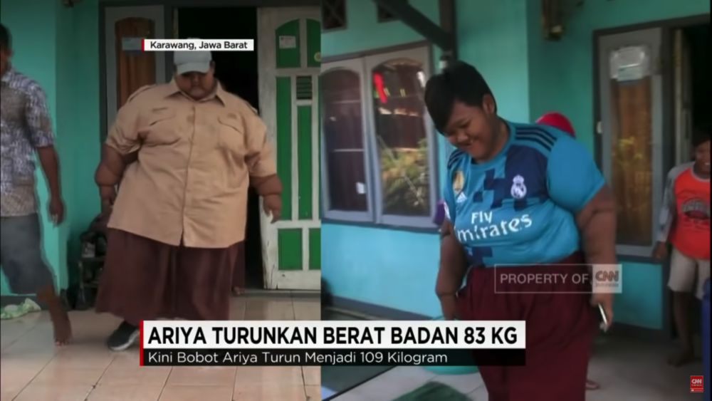 192kg世界一太った10歳の肥満児が83kgダイエット成功ビフォーアフター